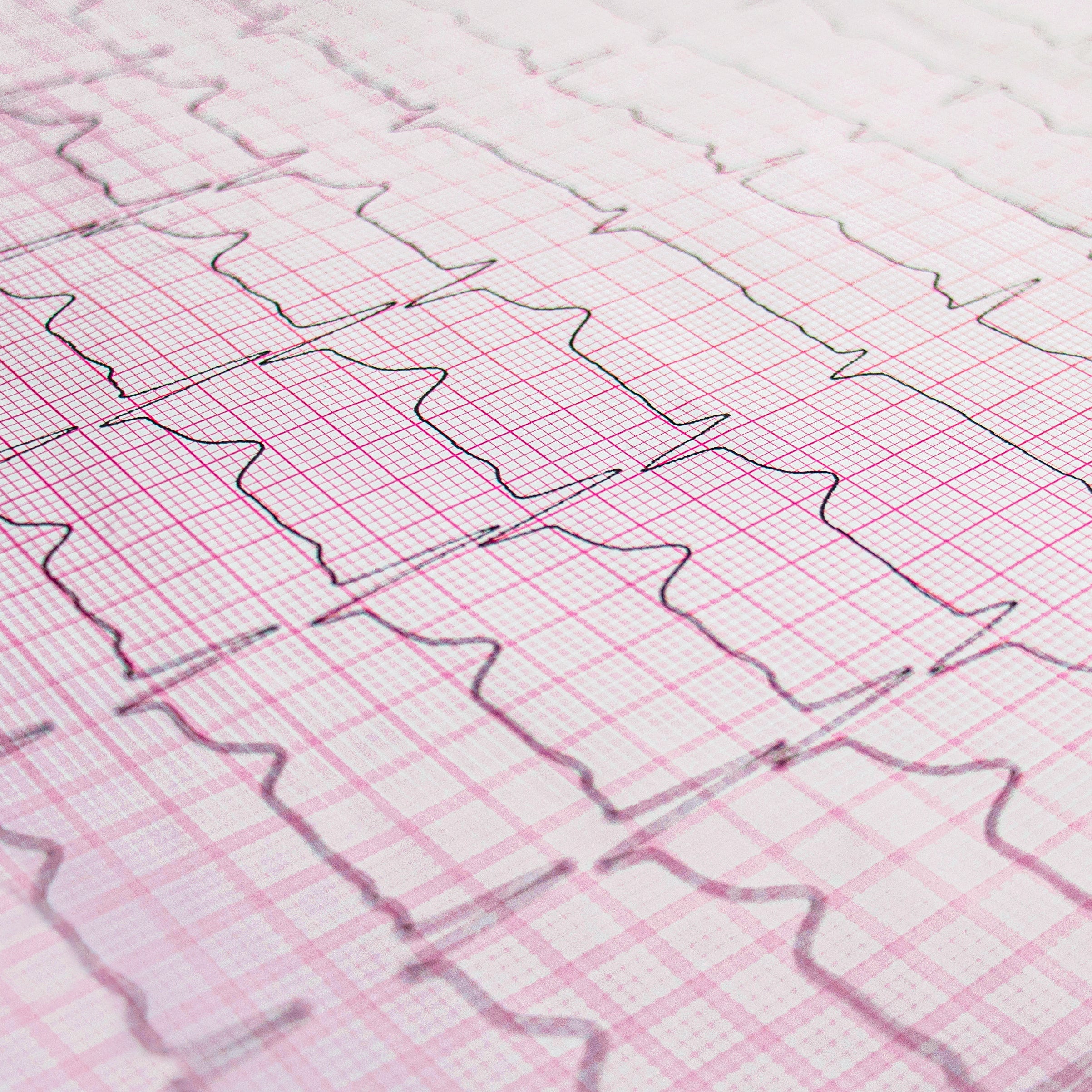12-Lead ECG – MyHydrate